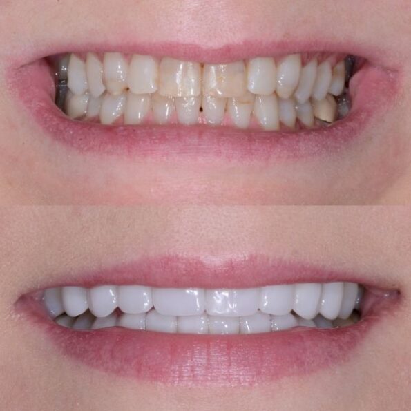 Galleries - The Chicago Dental Studio